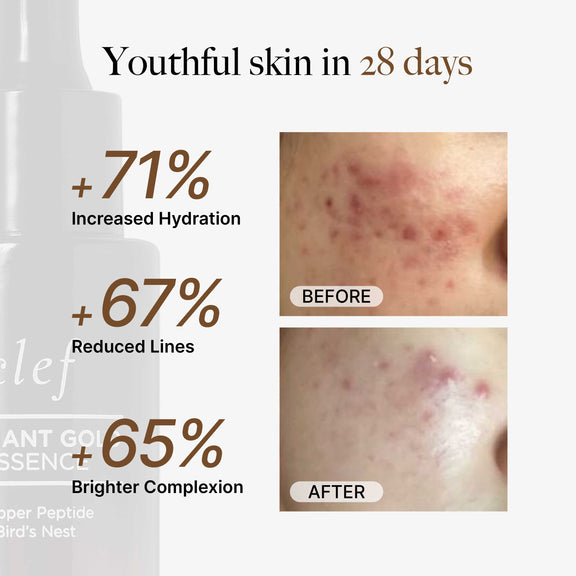 Radiant Gold Essence