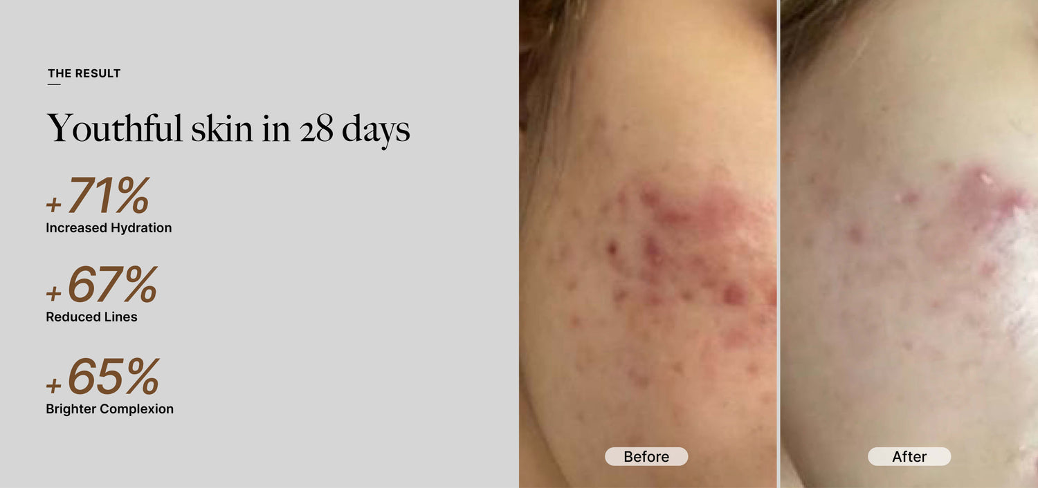 Shop CLEF Radiant Gold Essence Anti-Aging Serum