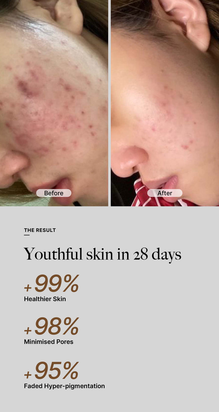Copper Peptide Mask | CLEF's Signature